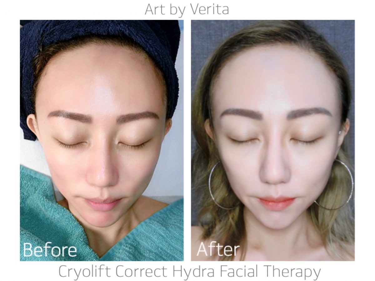 Cryolift Correct Hydra Therapy at Art by Verita – JPGLICIOUS